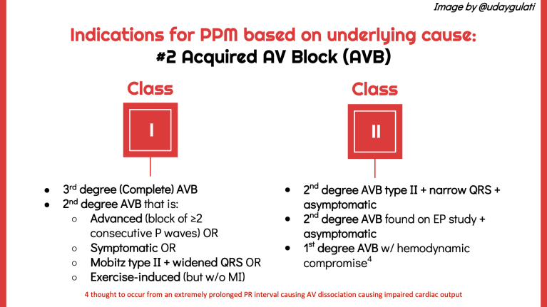 What are indications for a permanent pacemaker? – Inspired MedEd
