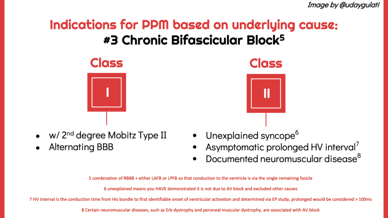 What are indications for a permanent pacemaker? – Inspired MedEd
