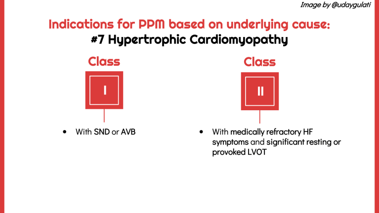 What are indications for a permanent pacemaker? – Inspired MedEd